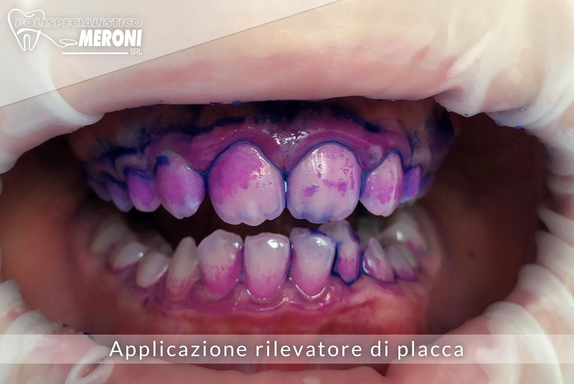 Polispecialistico Meroni | Il tuo dentista a Cantù (Como), impianti ...